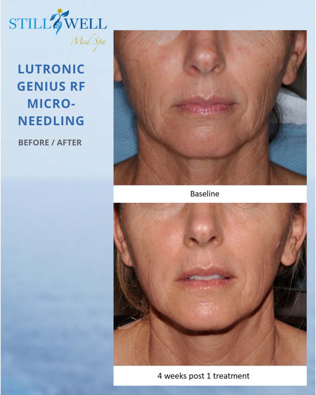 Specials & Events - Still Well Med Spa